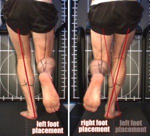 Can Correcting Your Cross-Over Gait Banish Your IT Band Problems ...
